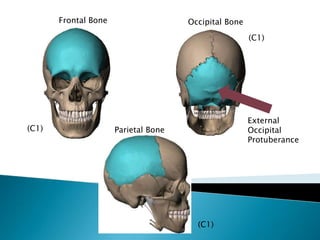 Bones artifact | PPTX | Death, Injury, or Military Conflict | Sensitive ...