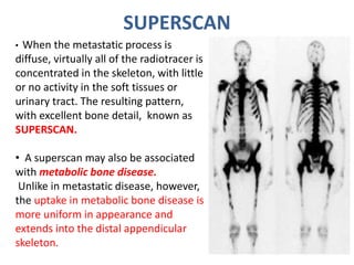 Bone scan in Orthopaedics | PPTX