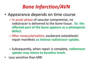 Bone scan in Orthopaedics | PPTX