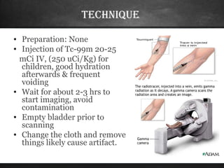 Bone scan | PPT