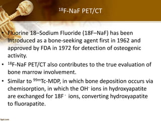 Bone Scan.pptxmmmmmmmmmmmmmmmmmmmmmmmmmmm | PPT