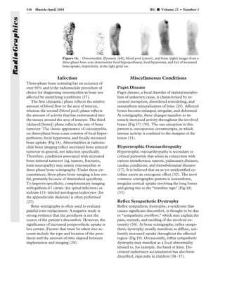 A detailed review of bone scintigraphy using Tc-99m, covering normal ...