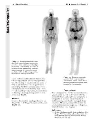 A detailed review of bone scintigraphy using Tc-99m, covering normal ...
