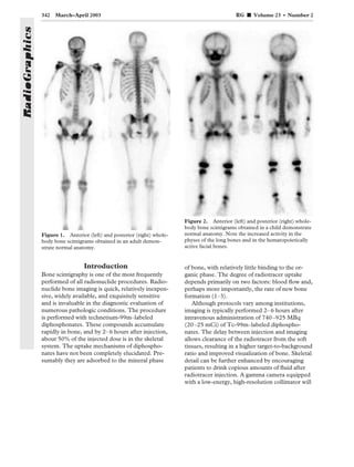 A detailed review of bone scintigraphy using Tc-99m, covering normal ...