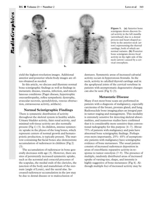 A detailed review of bone scintigraphy using Tc-99m, covering normal ...
