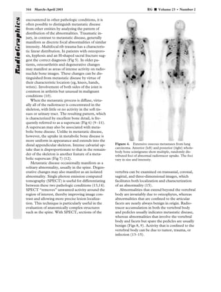 A detailed review of bone scintigraphy using Tc-99m, covering normal ...