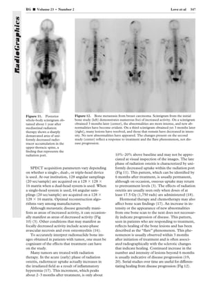 A detailed review of bone scintigraphy using Tc-99m, covering normal ...