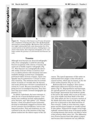A detailed review of bone scintigraphy using Tc-99m, covering normal ...