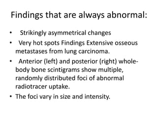 bone scan by Dr.Madeeha.pptx