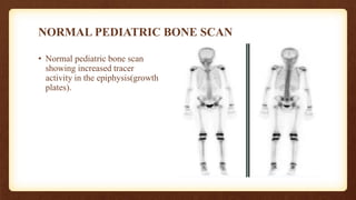 BONE SCINTIGRAPHY.pptx