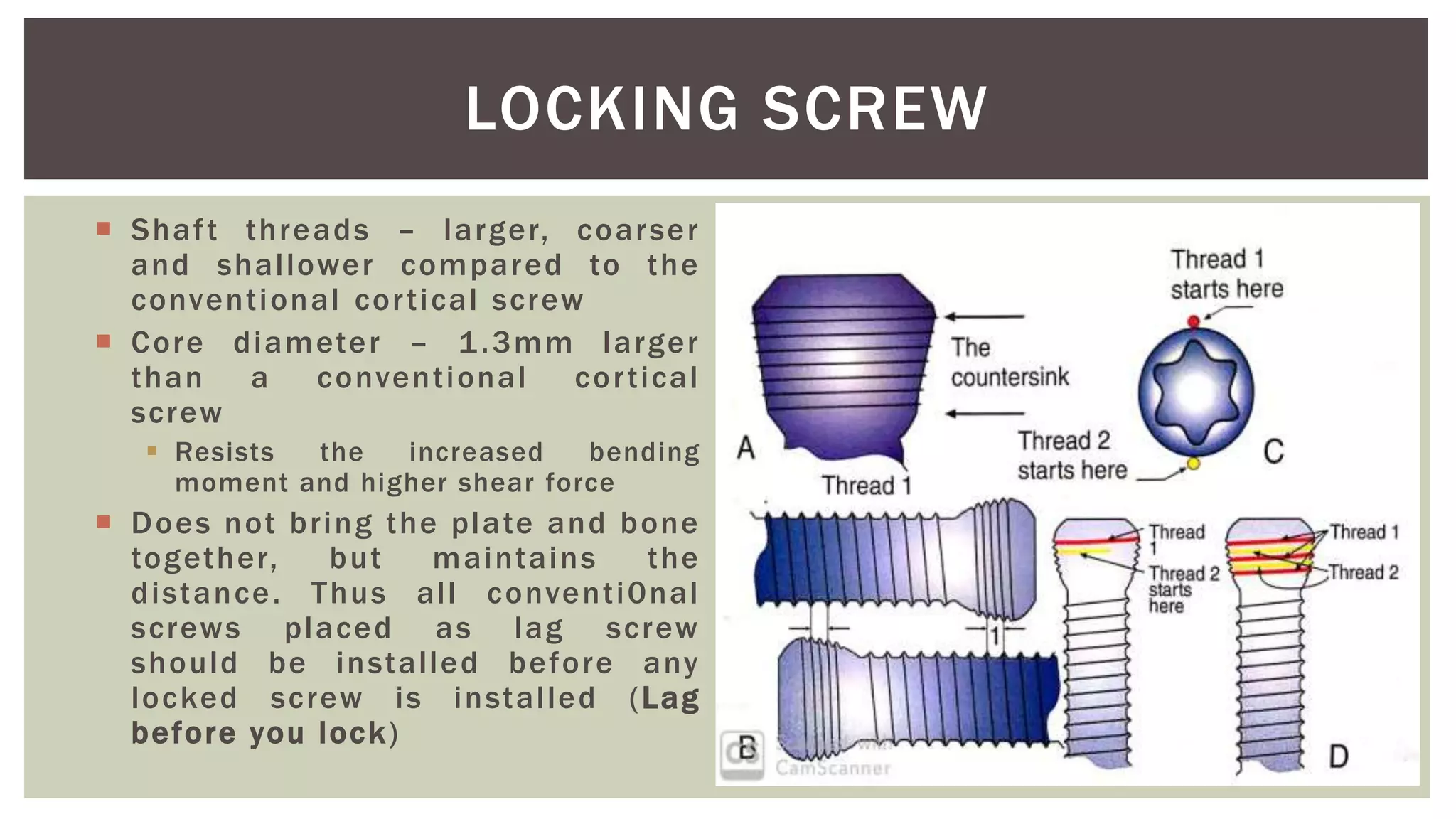 Bone screws - Principles and biomechanics - Dr. Sachin M | PPTX