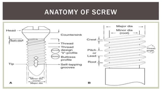 Bone screws - Principles and biomechanics - Dr. Sachin M | PPT