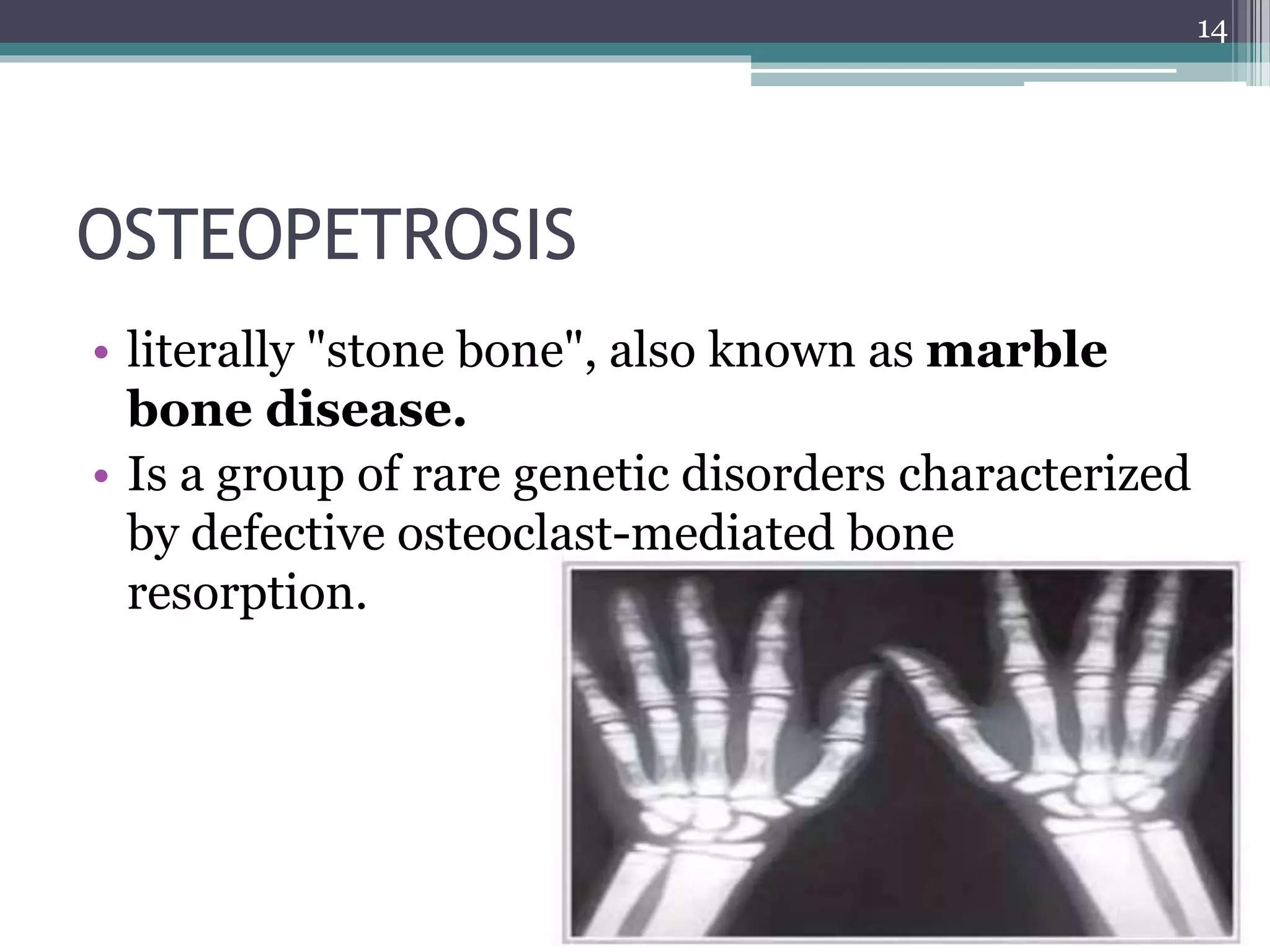 Bones,joints and soft tissue tumors | PPTX