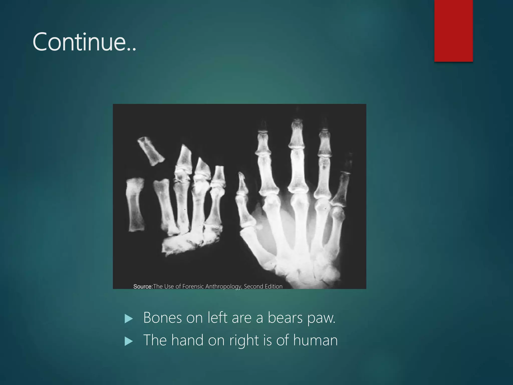 Bones or not ? | PPT