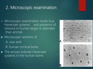 Bones or not ? | PPTX