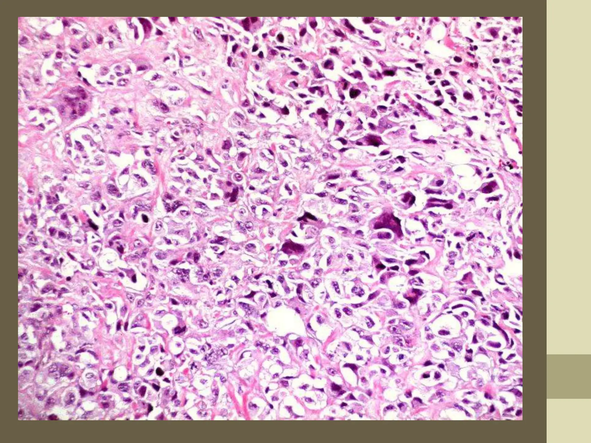 Pathology of Bones Pathology part II.pdf