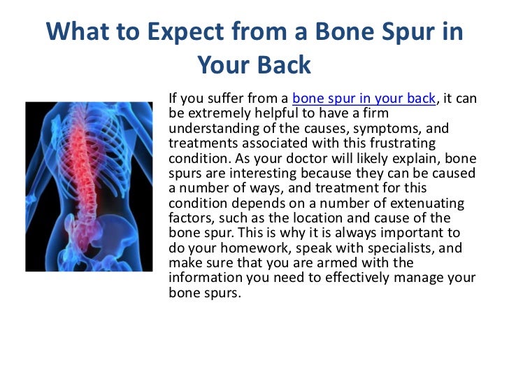 What To Expect From A Bone Spur In Your Back