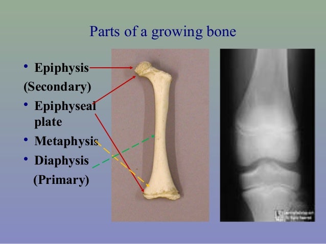 Proximal Epiphysis Long Bone Diagram