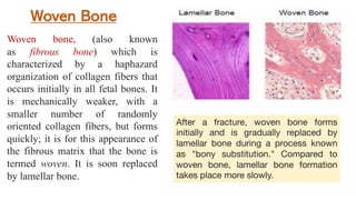 Bone structure and type | PPT