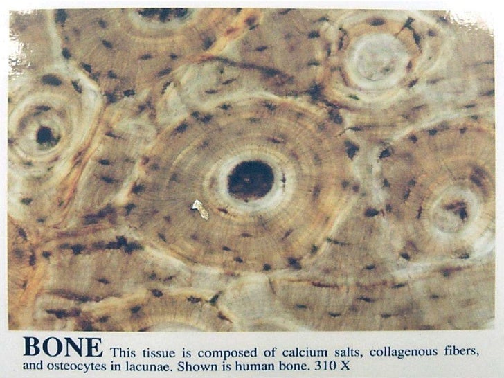 Bone tissue