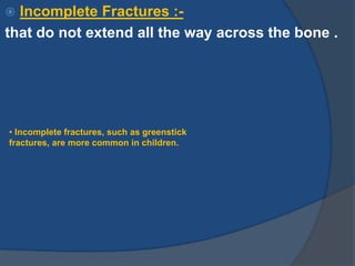 bone trauma common fractures long bone.ppt