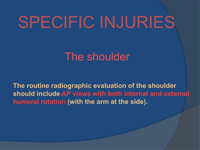 bone trauma common fractures long bone.ppt