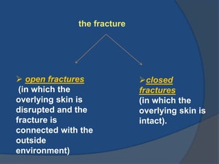 bone trauma common fractures long bone.ppt