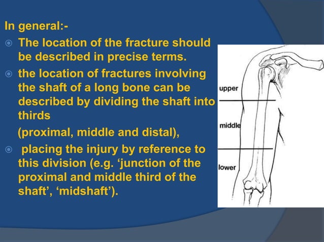 bone trauma common fractures long bone.ppt