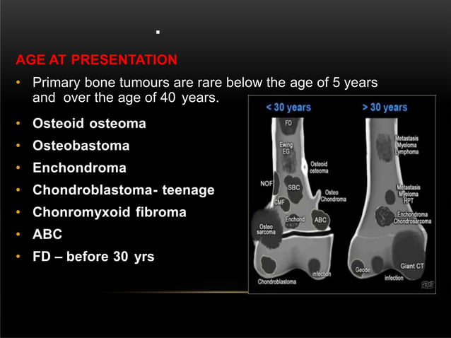 BENIGN Bone tumors | PPT
