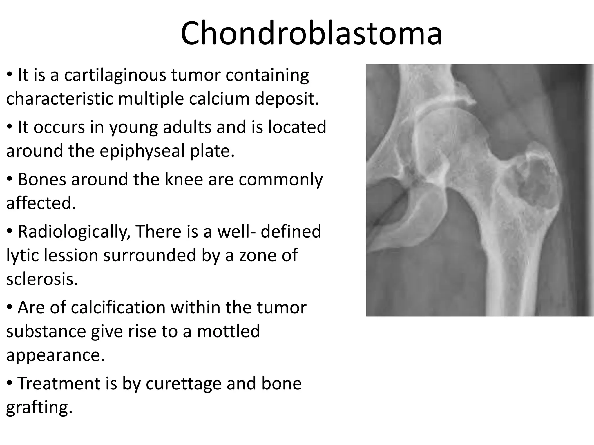 A lecture slide of Bone Tumor.pptx for nursing | PPTX
