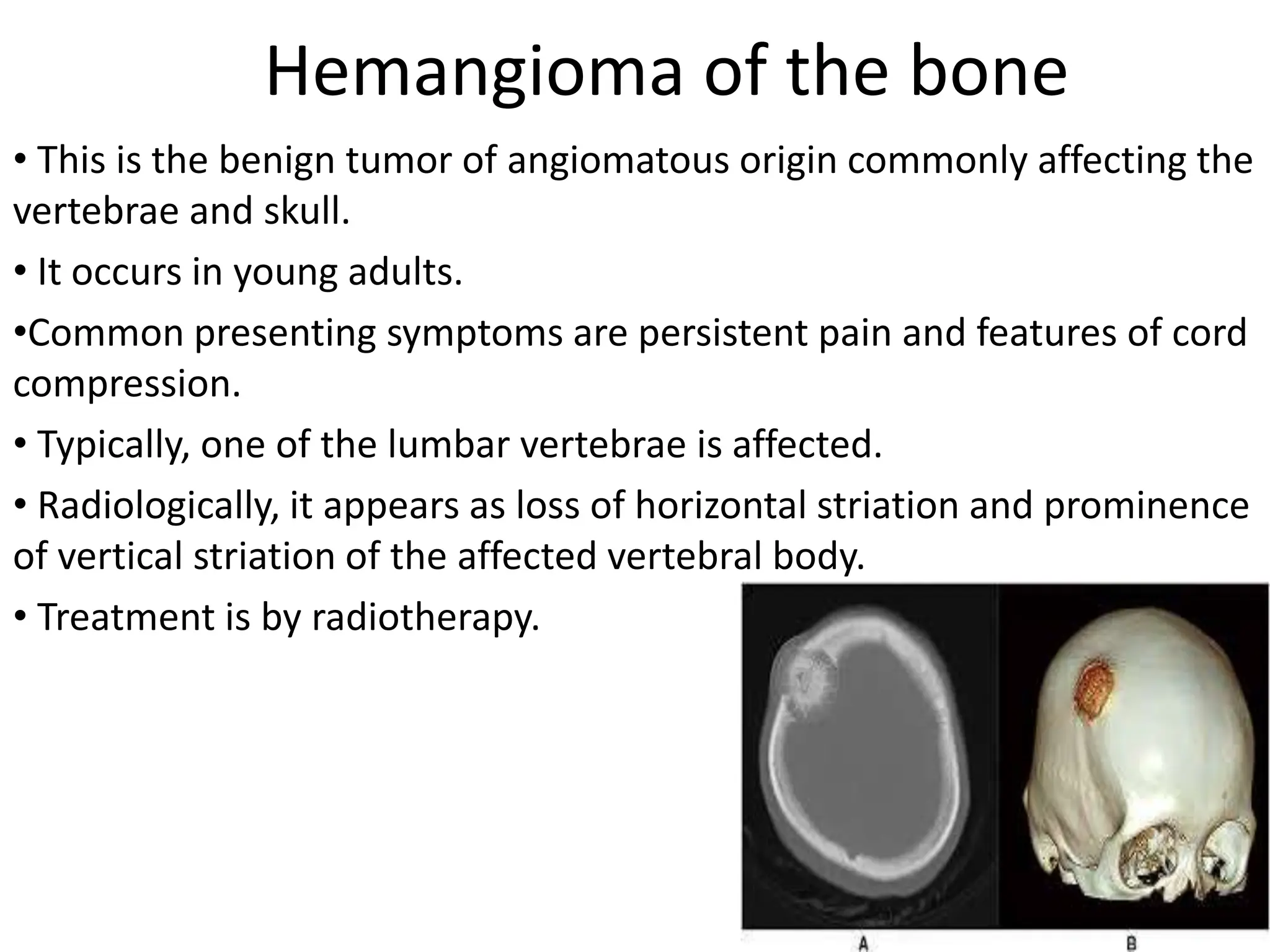 A lecture slide of Bone Tumor.pptx for nursing | PPTX