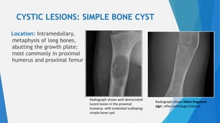 bone tumors-1.pptx