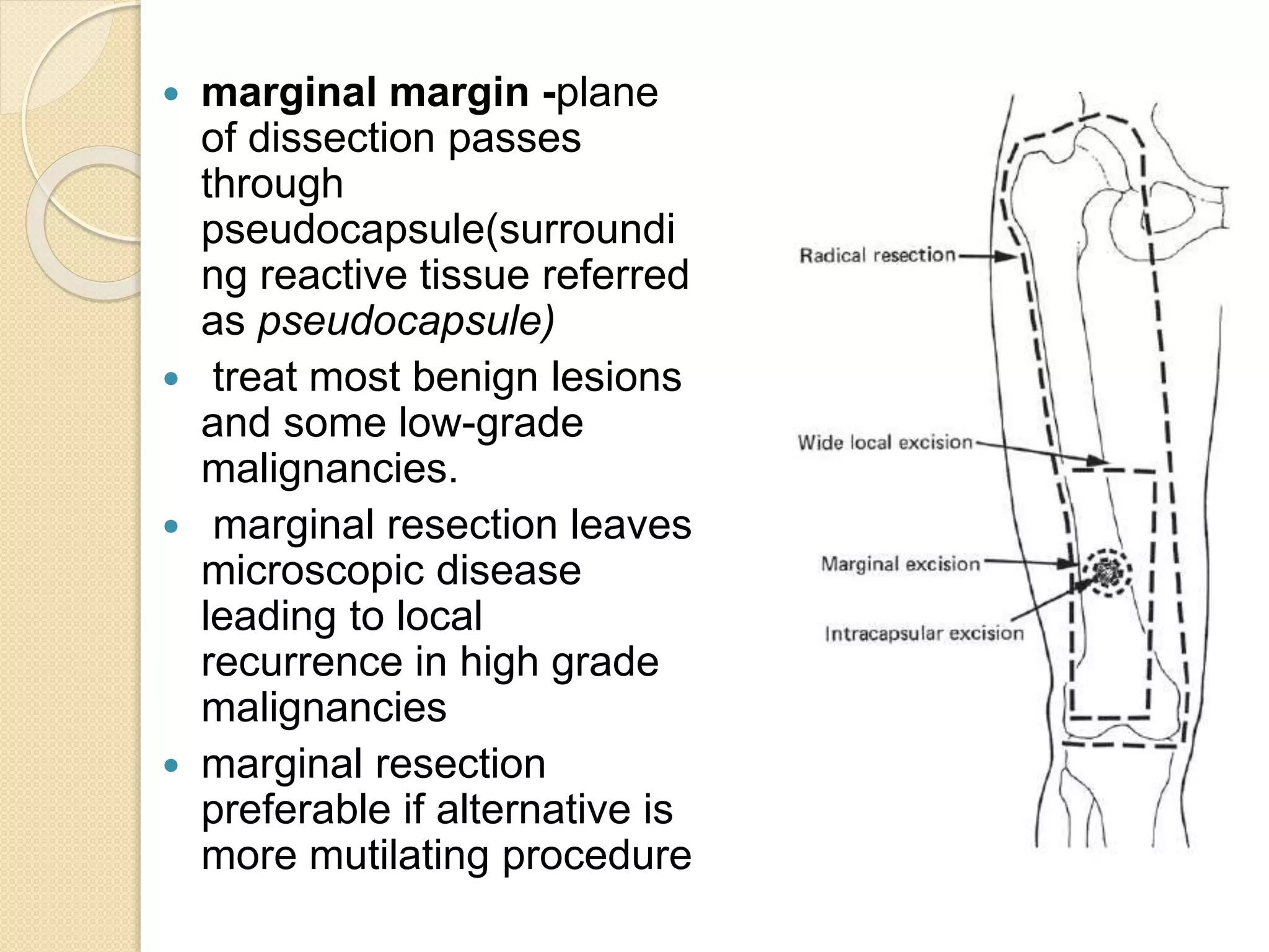 Bone tumors introduction and general principles | PPTX