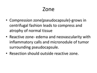 Bone tumors.pptx