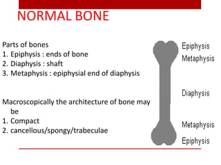 bone tumors.pptx