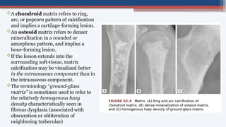 Imaging of Bone Tumors: Basic Approach and Mimics | PPTX