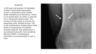 bone tumors final presentation in different sce | PPTX