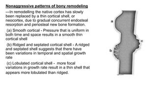 bone tumors final presentation in different sce | PPTX
