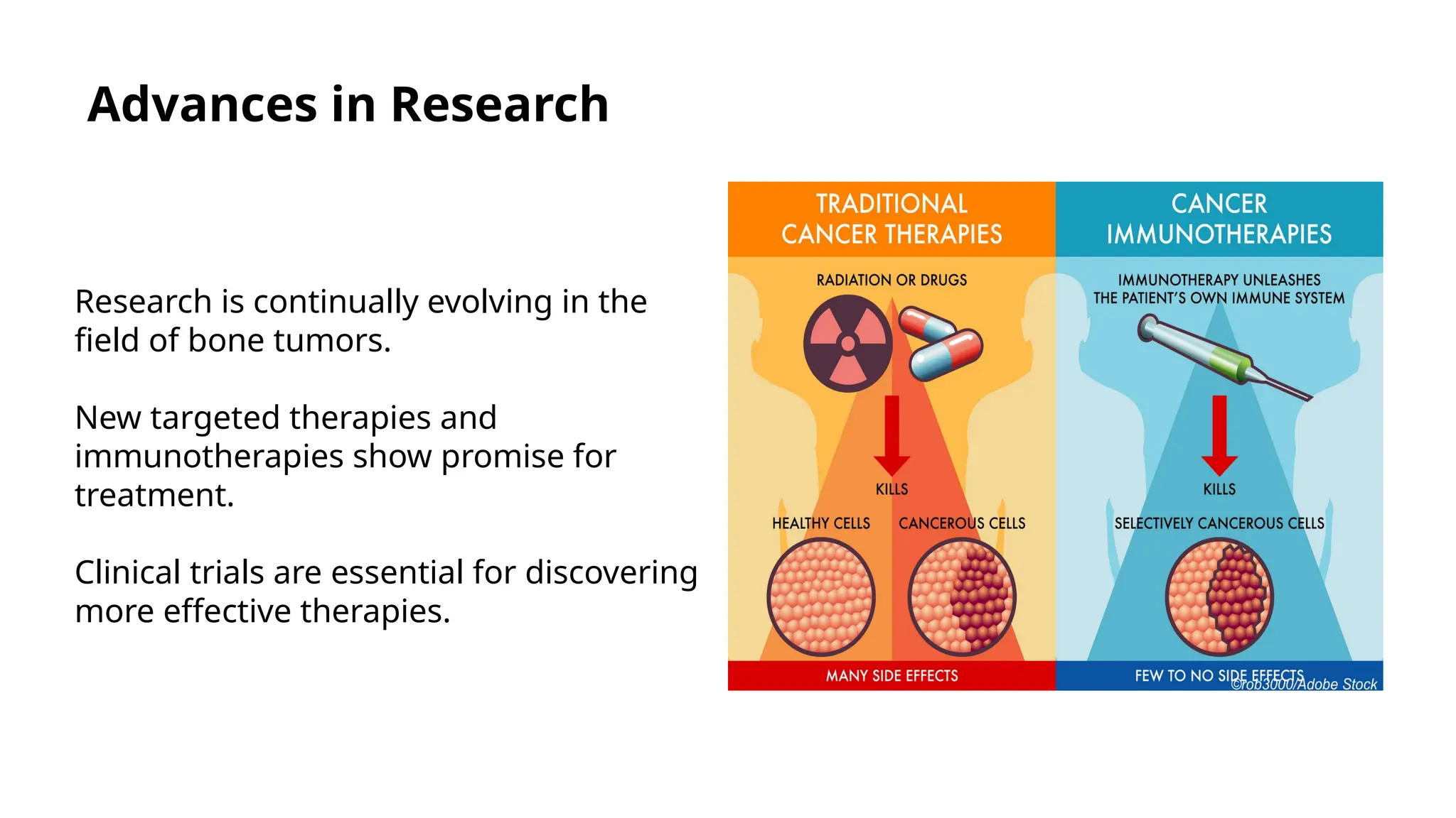 Bone Tumors new.pptx. . | PPTX