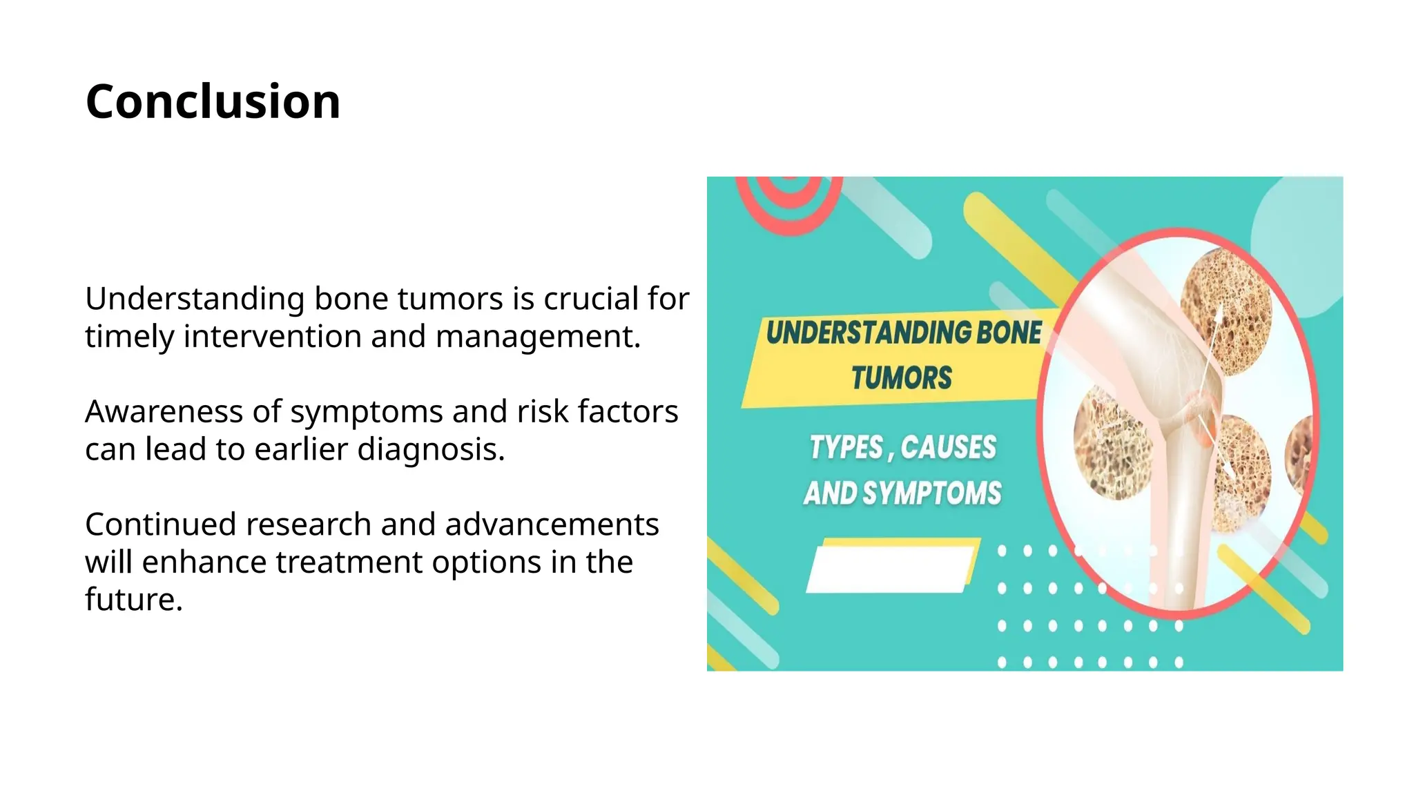 Bone Tumors new.pptx. . | PPTX