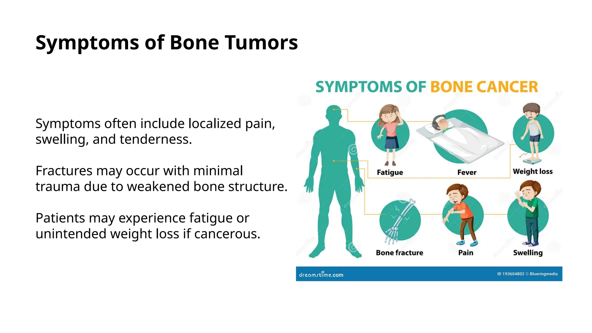 Bone Tumors new.pptx. . | PPTX
