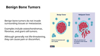 Bone Tumors new.pptx. . | PPTX