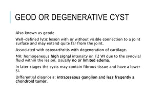 Bone tumors part 2 | PPT