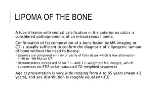 Bone tumors part 2 | PPT
