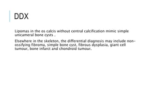 Bone tumors part 2 | PPT