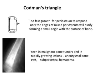 BONE TUMORS PPT nkjnkjnknknihjknbnkjnkjnj | PPTX