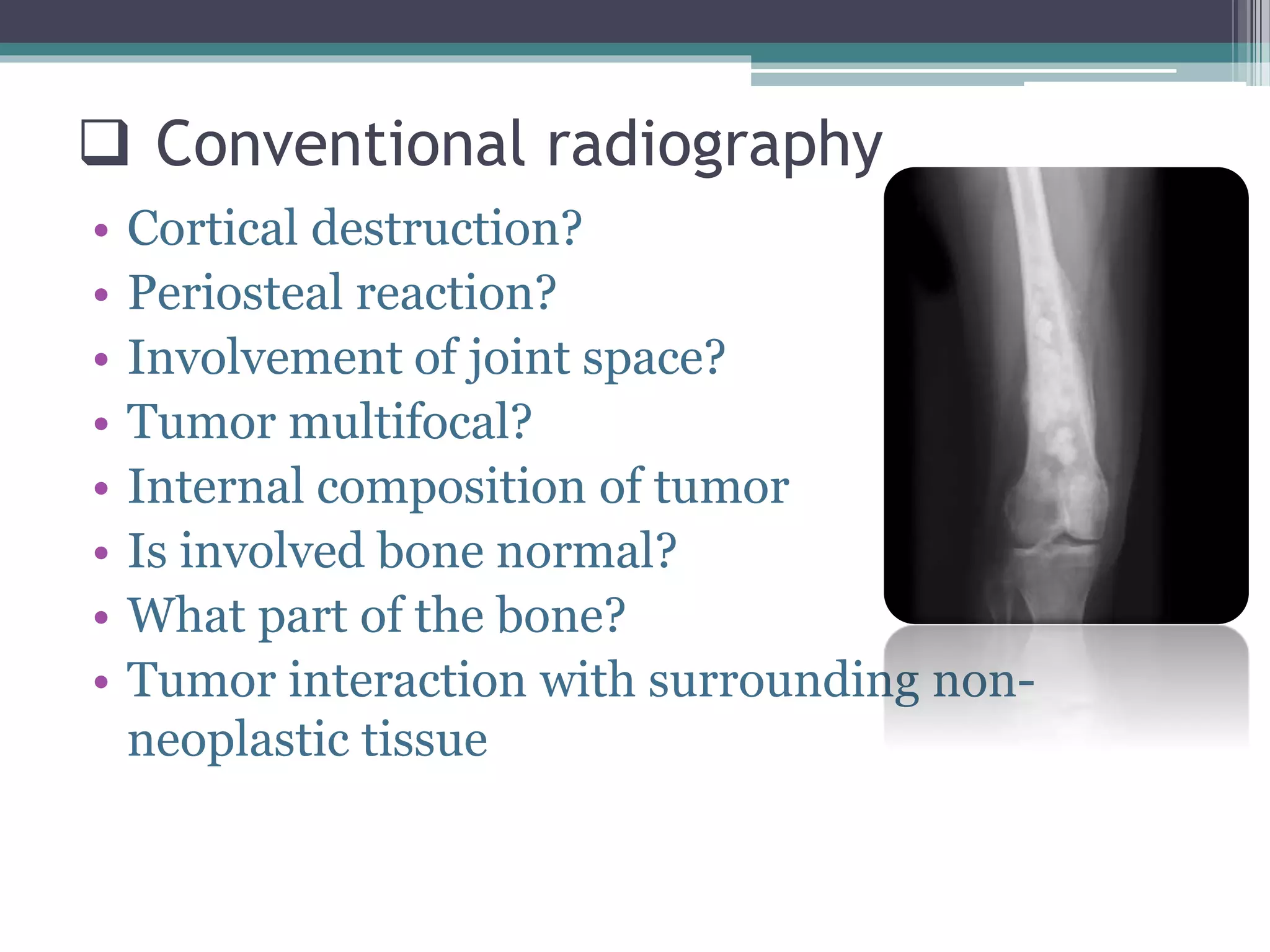 Bone tumor staging systems | PPTX