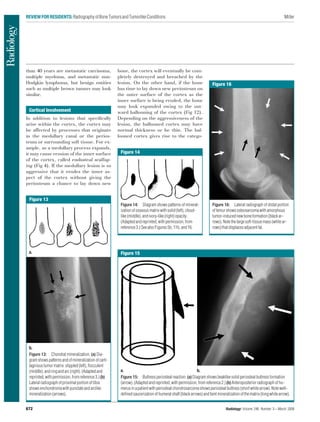 bone tumors x ray.pdfThis comprehensive review by Dr. Theodore T ...