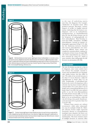bone tumors x ray.pdfThis comprehensive review by Dr. Theodore T. Miller outlines a systematic ...