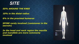 Bone tumour gct | PPT